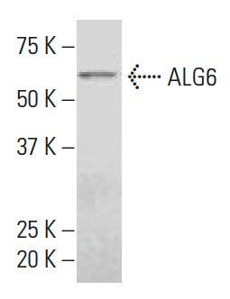 Anti-ALG6 Antibody (Z164) | SCBT - Santa Cruz Biotechnology