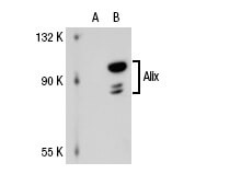 Anti-Alix Antibody (1A12) | SCBT - Santa Cruz Biotechnology