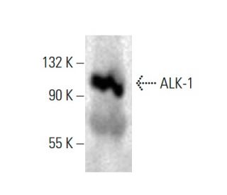 Anti-ALK-1 Antibody (F-1) | SCBT - Santa Cruz Biotechnology