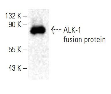 ALK-1 Antibody (F-1) | SCBT - Santa Cruz Biotechnology