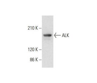 ALK Antibody (F-12) - Western Blotting - Image 308431