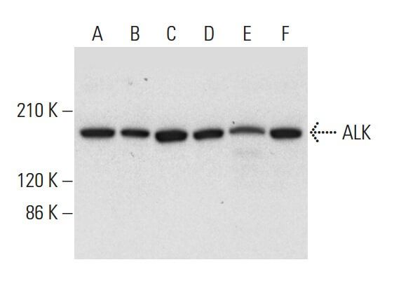 ALK Antibody (F-12) | SCBT - Santa Cruz Biotechnology