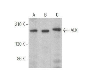 ALK Antibody (F-12) - Western Blotting - Image 353285