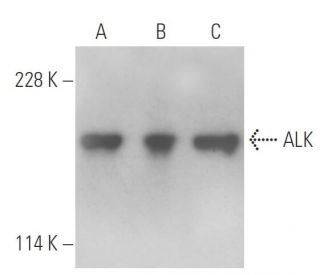 ALK Antibody (F-12) - Western Blotting - Image 399046