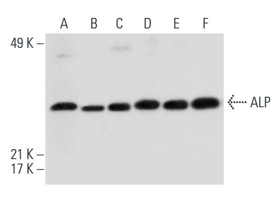 ALP Antibody (B-10) | SCBT - Santa Cruz Biotechnology