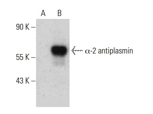 Anti-α-2 antiplasmin Antibody (C-7) | SCBT - Santa Cruz Biotechnology