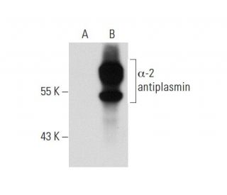 α-2 antiplasmin Antibody (JJ-16) - Western Blotting - Image 61813