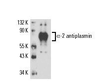 α-2 antiplasmin Antibody (MAP25C3) | SCBT - Santa Cruz Biotechnology