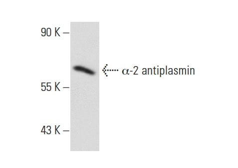 Anti-α-2 antiplasmin Antibody (SJ-19) | SCBT - Santa Cruz Biotechnology