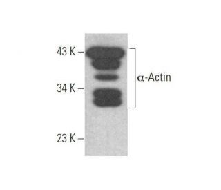 α-Actin Antibody (0.N.5) - Western Blotting - Image 353322