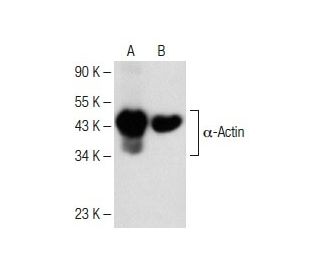 α-Actin Antibody (1A4) - Western Blotting - Image 150093
