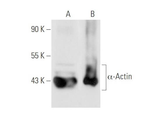 α-Actin抗体 (5C5) | SCBT - Santa Cruz Biotechnology