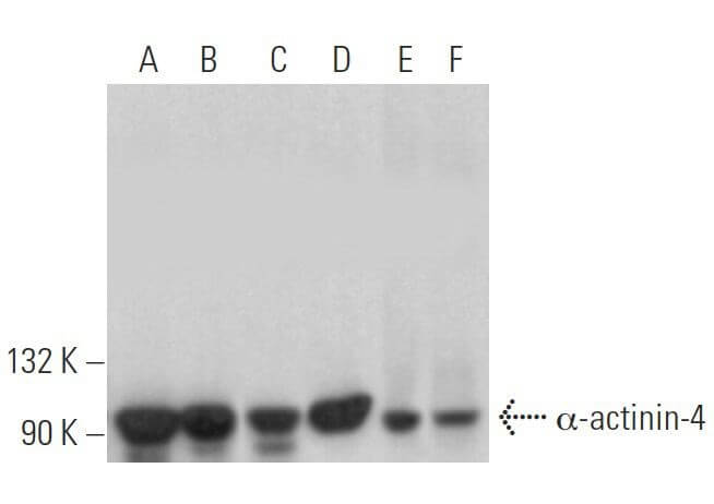 Anti-α-actinin-4 Antibody (G-4) | SCBT - Santa Cruz Biotechnology