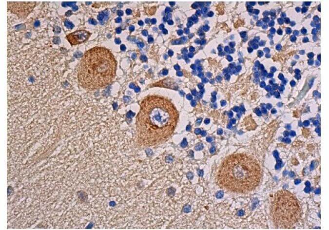 α-Adaptin 1 Antibody (F-9) | SCBT - Santa Cruz Biotechnology