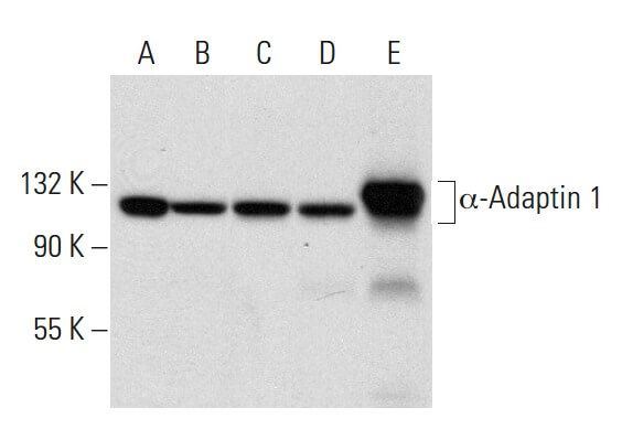α-Adaptin 1 Antibody (F-9) | SCBT - Santa Cruz Biotechnology