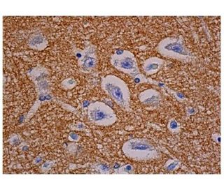 α/β-synuclein Antibody (Syn 202) - Immunohistochemistry - Image 350539