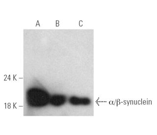 α/β-synuclein Antibody (Syn 202) - Western Blotting - Image 390089