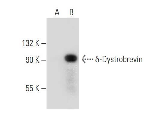Anti-α-Dystrobrevin Antibody (B-1) | SCBT - Santa Cruz Biotechnology