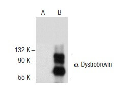 α-Dystrobrevin Antibody (B-2) | SCBT - Santa Cruz Biotechnology