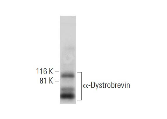 α-Dystrobrevin Antibody (B-2) | SCBT - Santa Cruz Biotechnology