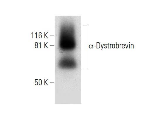α-Dystrobrevin Antibody (B-2) | SCBT - Santa Cruz Biotechnology
