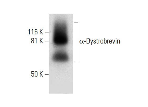 α-Dystrobrevin Antibody (B-2) | SCBT - Santa Cruz Biotechnology
