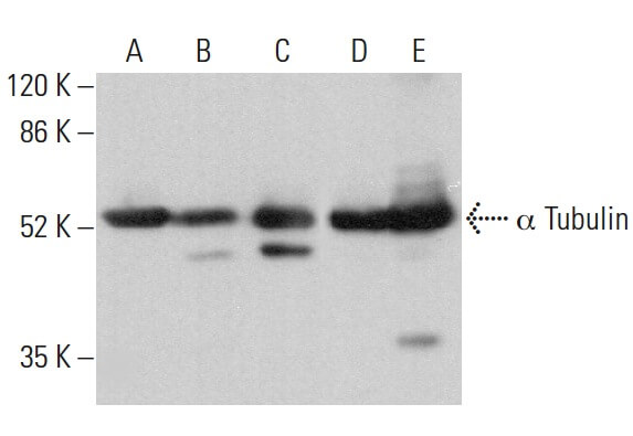 α Tubulin Antibody (B-5-1-2) | SCBT - Santa Cruz Biotechnology