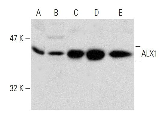 ALX1 Antibody (96K) | SCBT - Santa Cruz Biotechnology