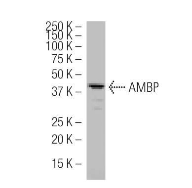 AMBP Antibody (532) | SCBT - Santa Cruz Biotechnology