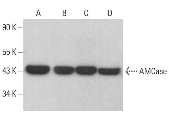 AMCase Antibody (E-11) | SCBT - Santa Cruz Biotechnology