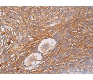 Anti-AMIGO2 Antibody (G-7) | SCBT - Santa Cruz Biotechnology