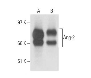 Anti-Angiopoietin 2/Ang-2/ANGPT2 Antibody (F-1) | SCBT - Santa Cruz ...