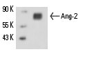 Anti-Angiopoietin 2/Ang-2/ANGPT2 Antibody (F-1) | SCBT - Santa Cruz ...