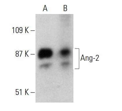 Angiopoietin 2/Ang-2/ANGPT2 Antibody (F-1) | SCBT - Santa Cruz ...