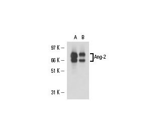 Anti-Angiopoietin 2/Ang-2/ANGPT2 Antibody (H-11) | SCBT - Santa Cruz ...