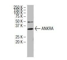 ANKRA Antibody (A26) | SCBT - Santa Cruz Biotechnology