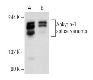 Ankyrin-1 Antibody (H-4) | SCBT - Santa Cruz Biotechnology