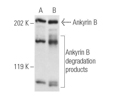 Anti-Ankyrin B Antibody (2.20) | SCBT - Santa Cruz Biotechnology