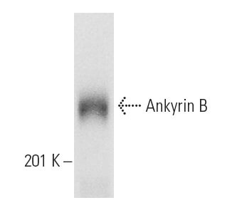 Anti-Ankyrin B Antibody (2.20) | SCBT - Santa Cruz Biotechnology