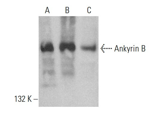 Ankyrin B Antibody (2.20) | SCBT - Santa Cruz Biotechnology