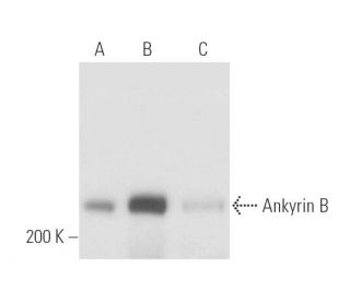 Ankyrin B Antibody (3G7) - Western Blotting - Image 17123