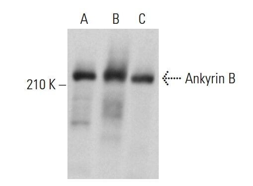 Ankyrin B Antibody (3G7) | SCBT - Santa Cruz Biotechnology