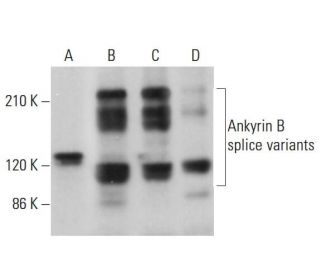 Ankyrin B Antibody (3G7) | SCBT - Santa Cruz Biotechnology