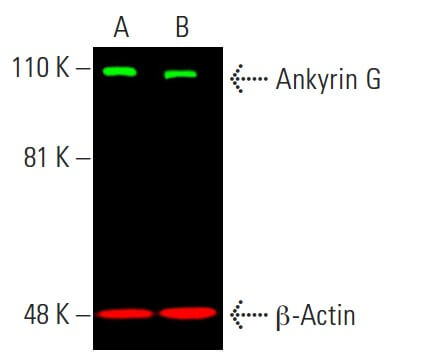 Ankyrin G Antibody (463) | SCBT - Santa Cruz Biotechnology