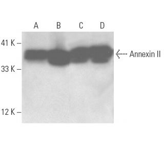 Annexin II Antibody (C-10) - Western Blotting - Image 9883