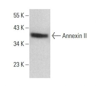 Annexin II Antibody (C-10) - Western Blotting - Image 380500