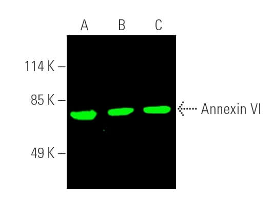 Anti-Annexin VI Antibody (E-5) | SCBT - Santa Cruz Biotechnology