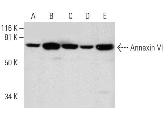 Annexin VI Antibody (G-10) | SCBT - Santa Cruz Biotechnology