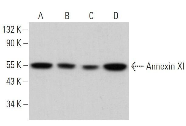 Annexin XI Anticorpo (L-19) | SCBT - Santa Cruz Biotechnology