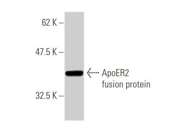 ApoER2抗体 (1A1) | SCBT - Santa Cruz Biotechnology